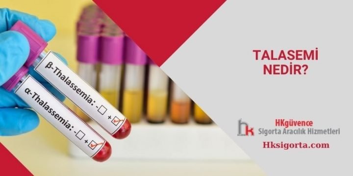 Talasemi Nedir | HK Sigorta Acenteliği
